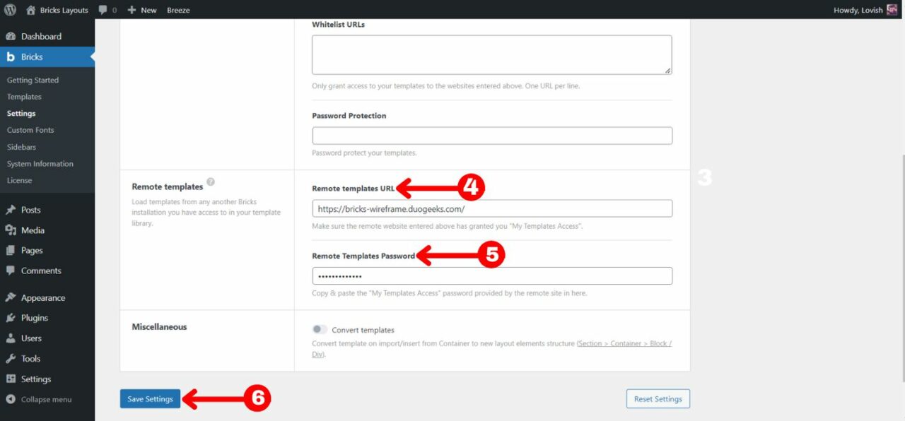 How To Setup Remote Template - Bricks Awesome