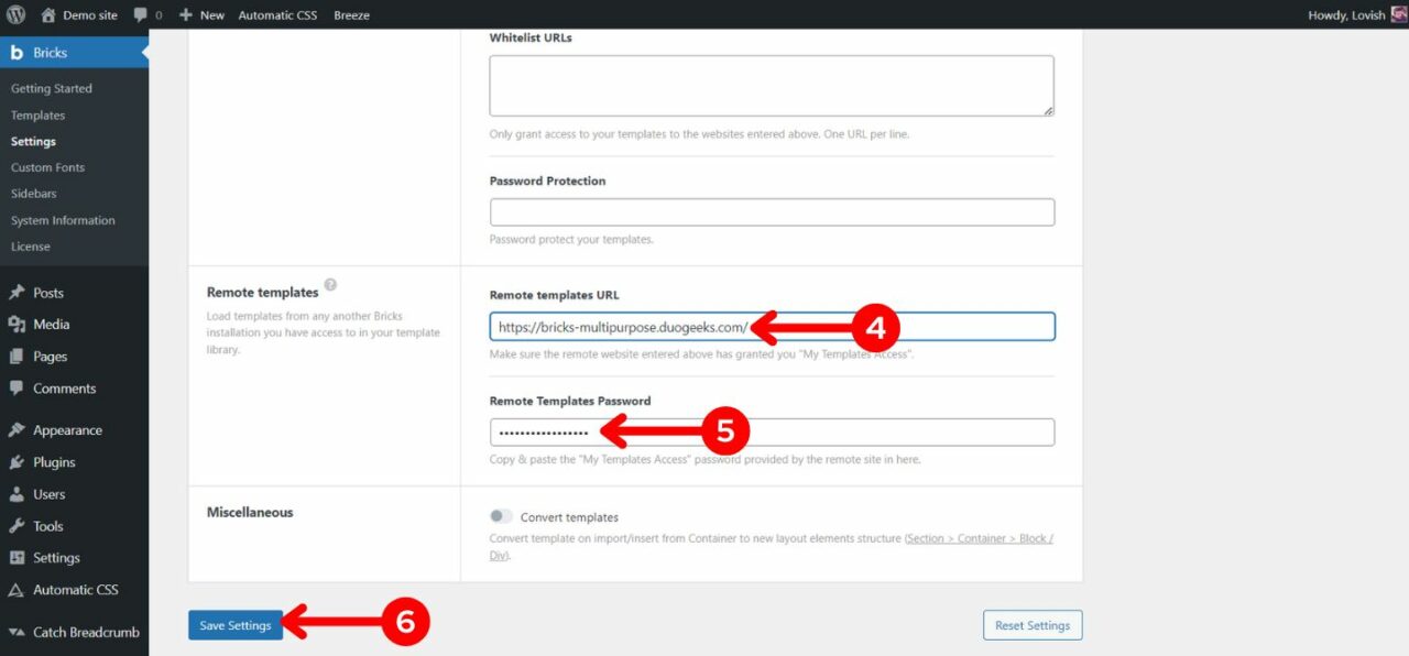 How to setup a Remote Template - Bricks Awesome